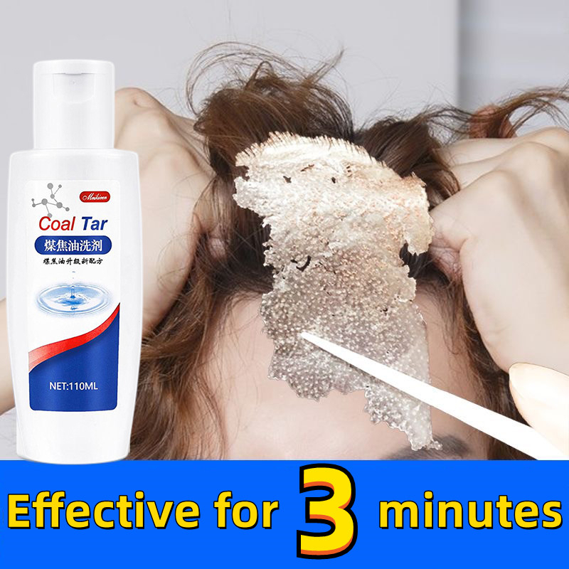 Anti Dandruff Shampoo Coal Tar Shampoo Syampoo Kelemumur Dan Rambut