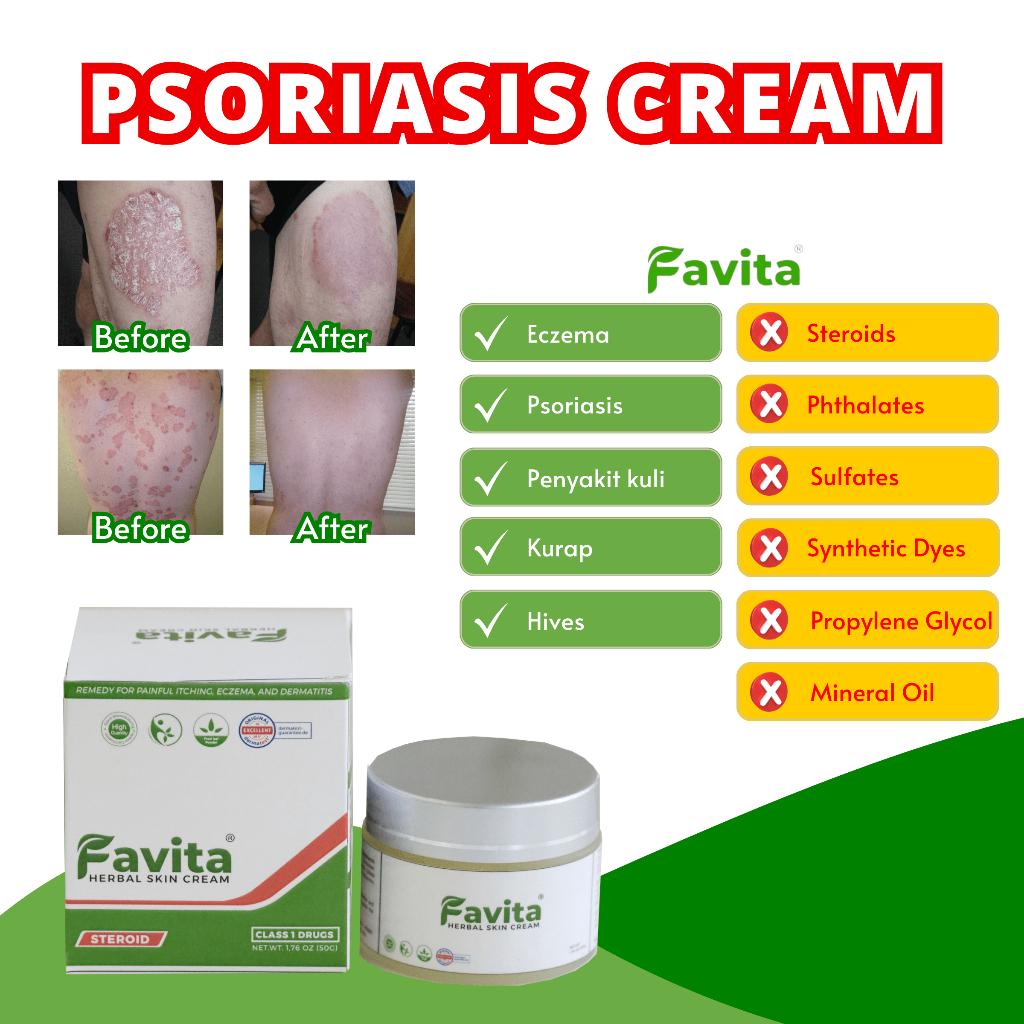 Favita Cream dan Pill Solusi Cepat Atasi Kulit Gatal, Psoriasis, dan ...