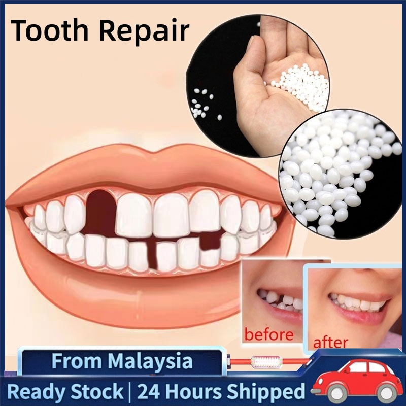 DIY Fix Tooth Filling Solid Denture Material Temporary Tooth DIY False ...