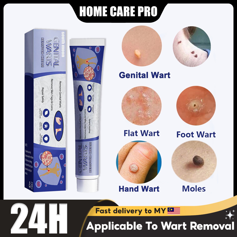 🔥MY 24h🔥Wart Removal Cream Genital Wart Removal Cream Mole Skin Tag ...