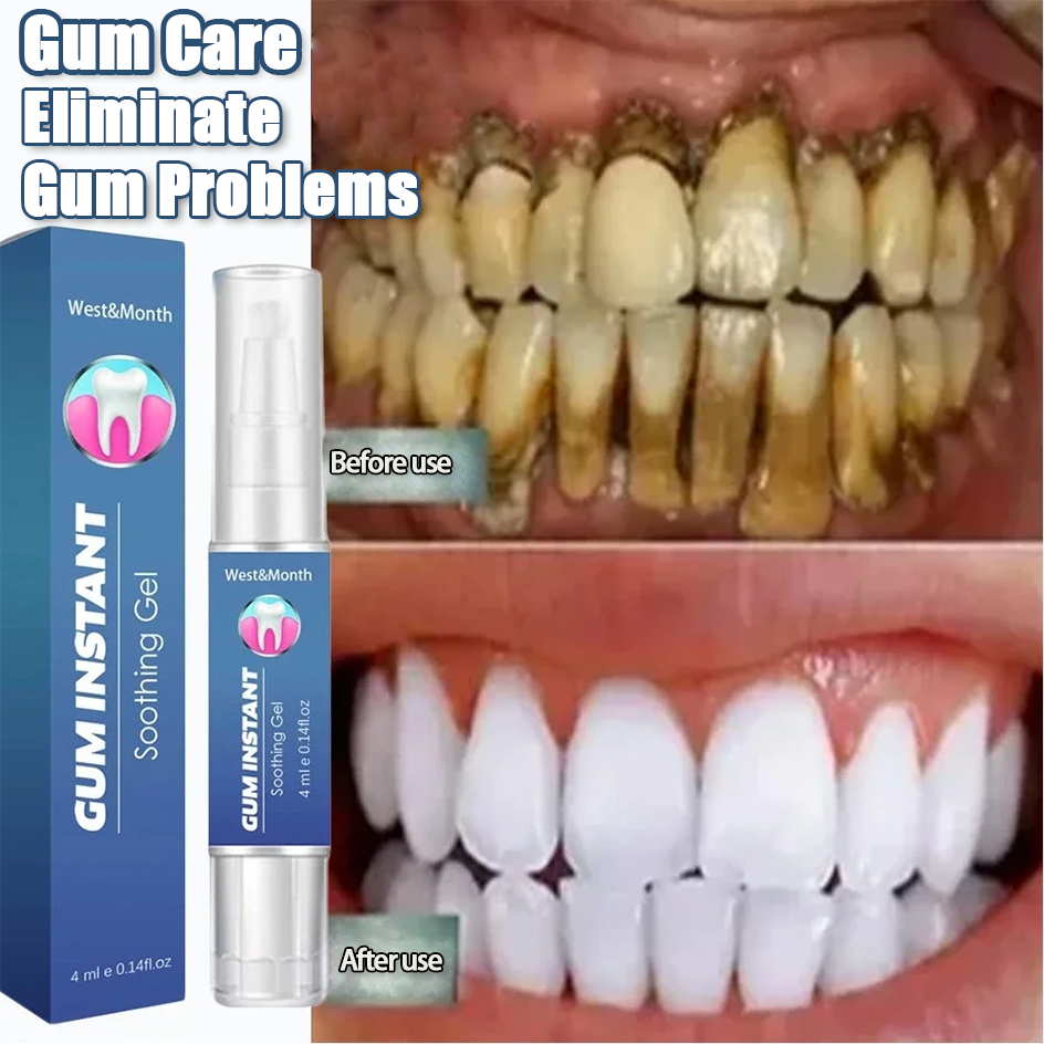 Gum Instant Soothing Gel Gum Care Gel Receding Gums Therapy Teeth ...
