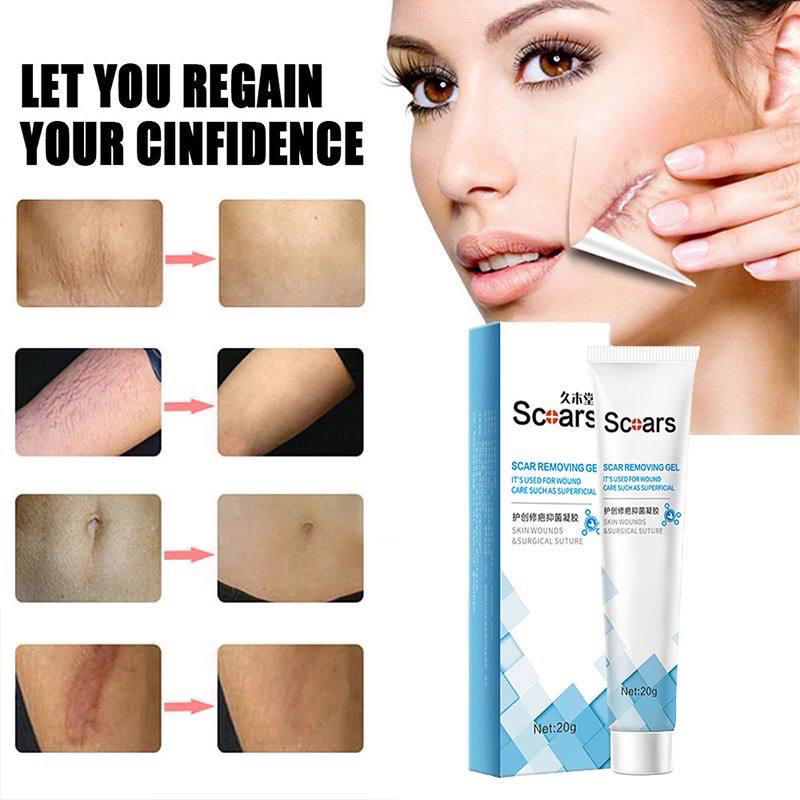 SKIN SCAR REMOVING GEL anti parut penghilang parut selulit luka oprate ...