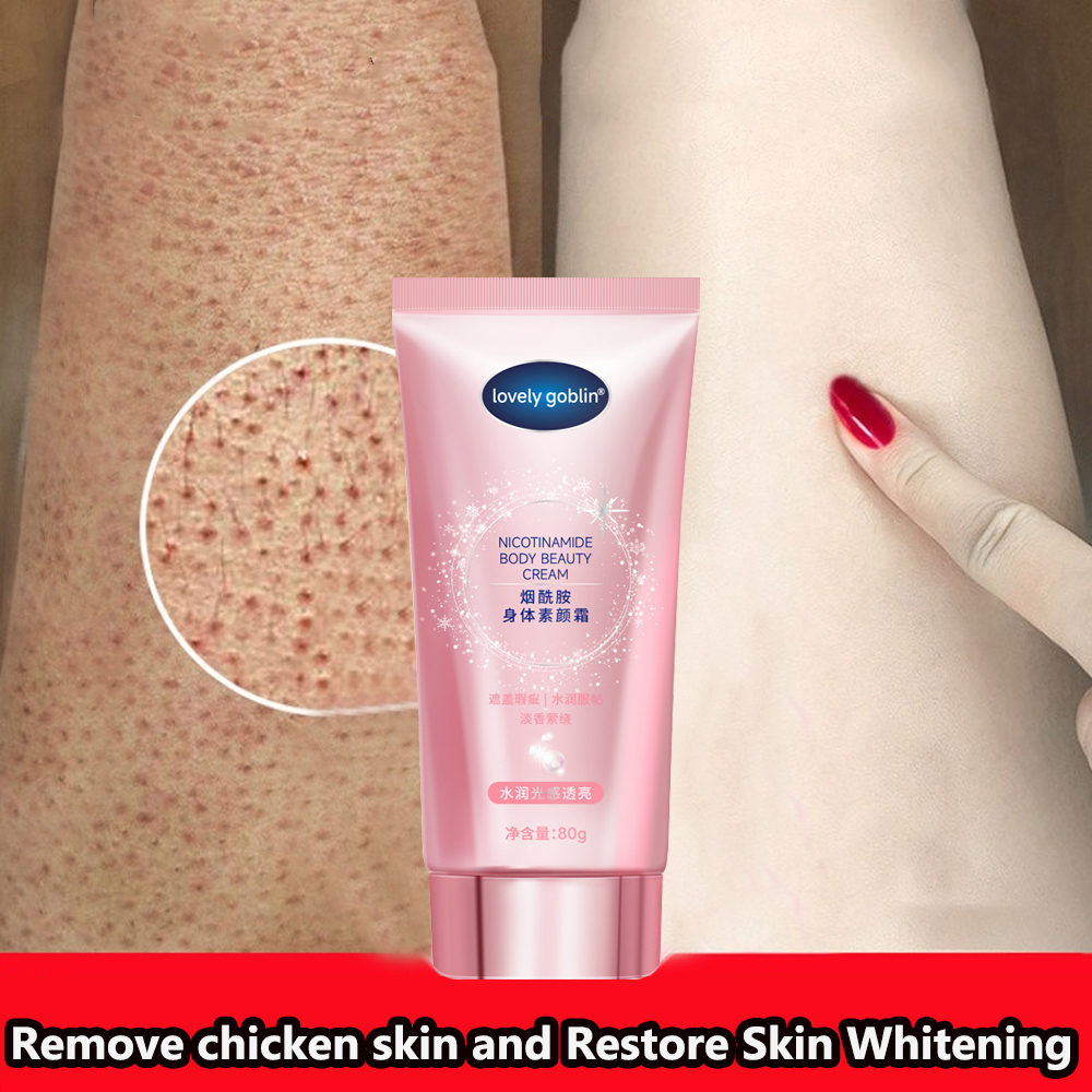 Nicotinamide body whitening cream 80g exfoliate chicken skin removal ...