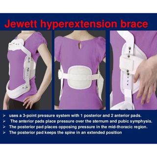 Jewett Brace for Hyperextension Assist Body Slip Disc and Surgery ...