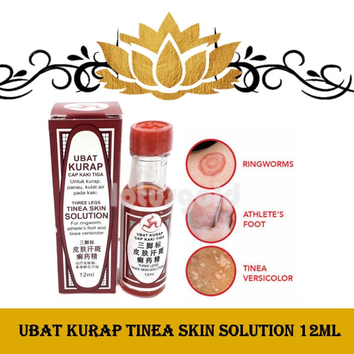 UBAT KURAP TINEA SKIN SOLUTION 12ML | Shopee Malaysia