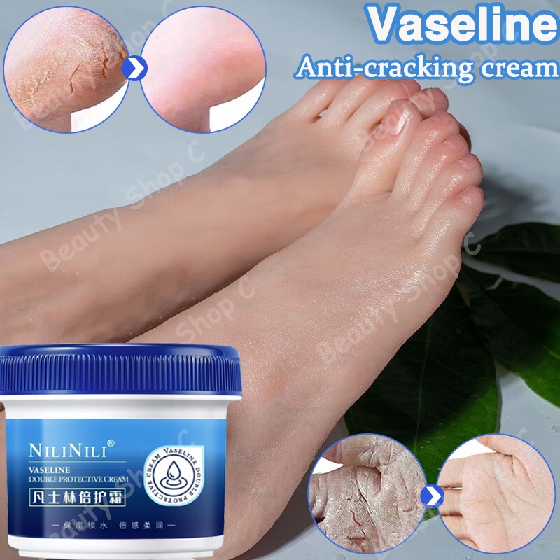 Cracked Heel Cream Vaseline Hand Cream 40g Remove Dead Skin Prevent