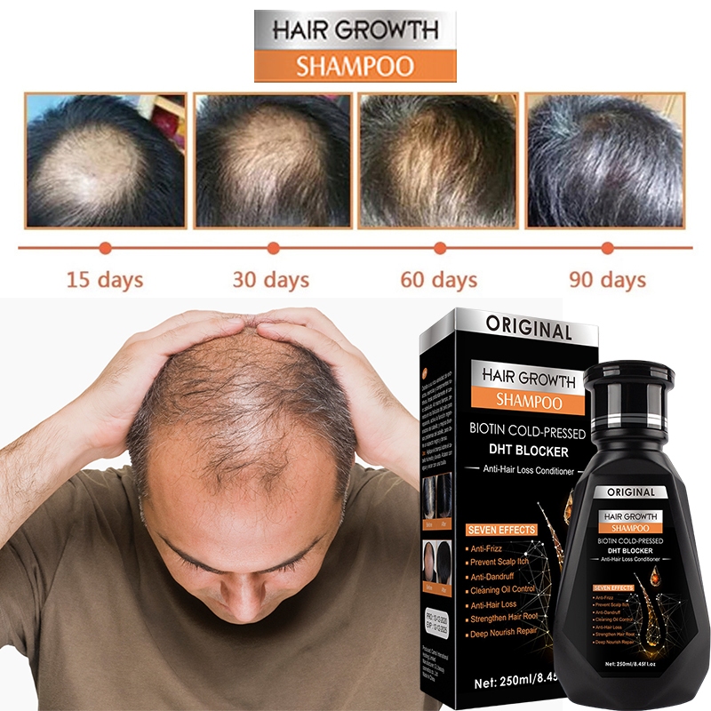original ginger shampoo rambut gugur hair growth serum anti hair fall ...