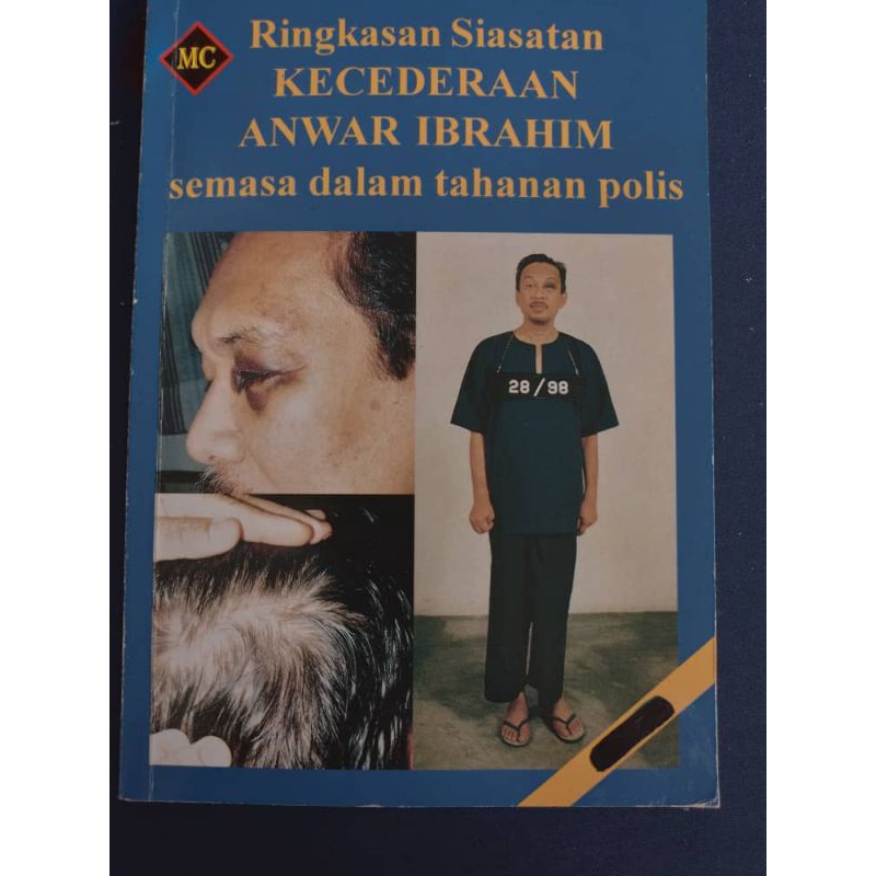 Ringkasan siasatan kecederaan Anwar Ibrahim semasa dalam tahanan polis ...