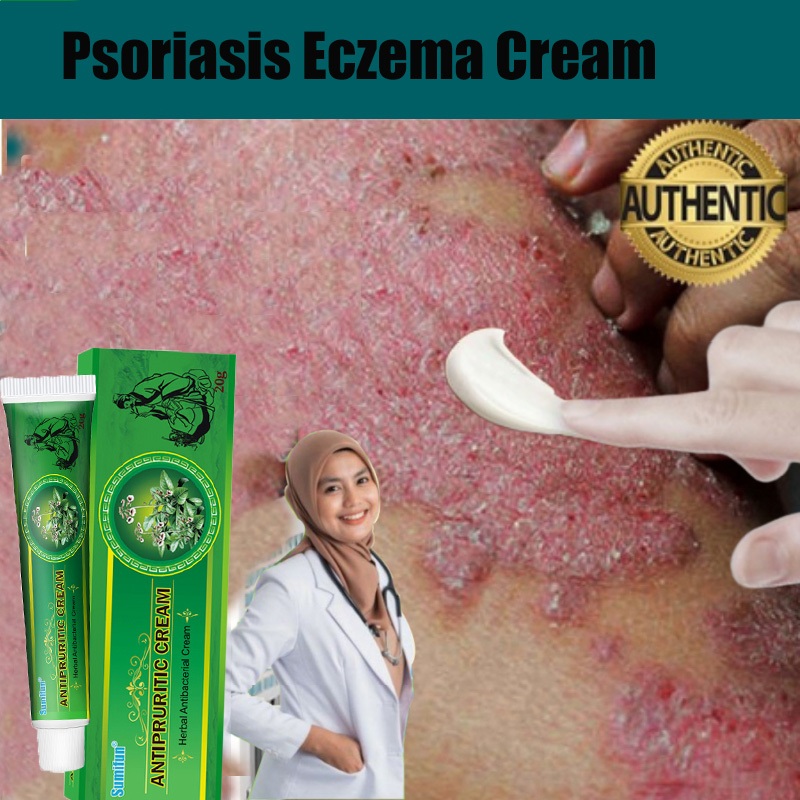 krim gatal kulit ubat gatal celah kangkang eczema psoriasis cream Ubat ...