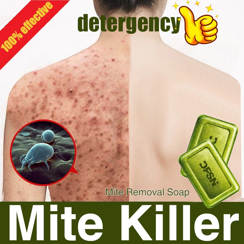 soap - sulfur soap - sabun eczema 110g 硫磺皂 Mite Killer Remove mites and ...