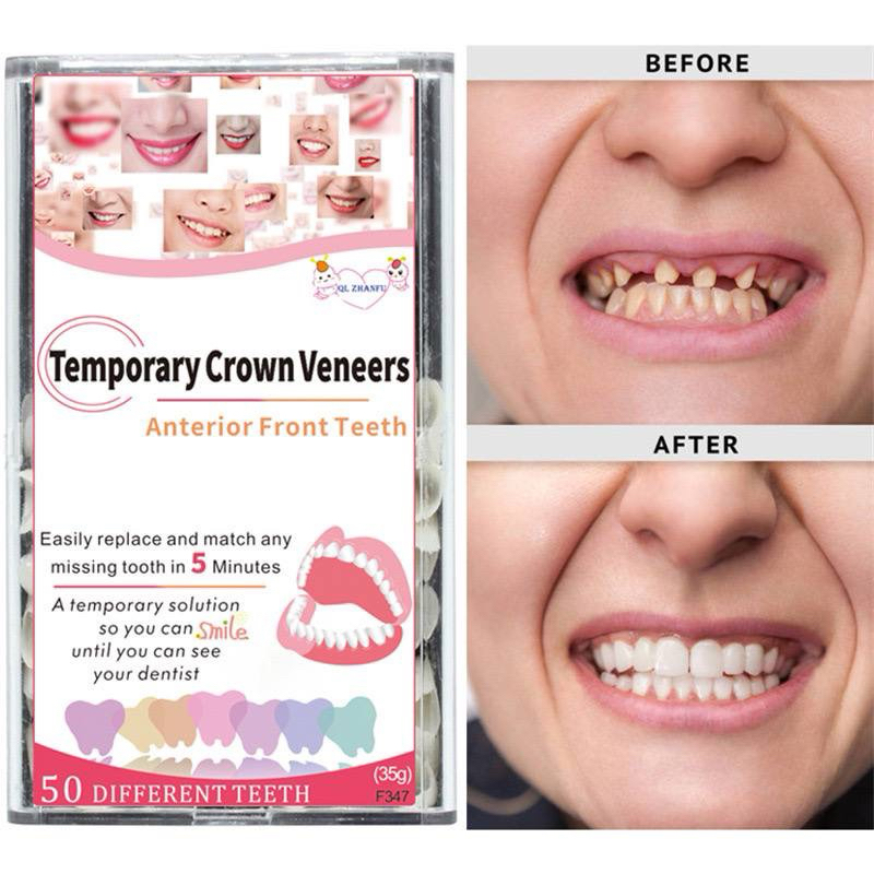 TEMPORARY CROWN VENEERS MOLAR TEETH gigi palsu diy murah flase teeth ...
