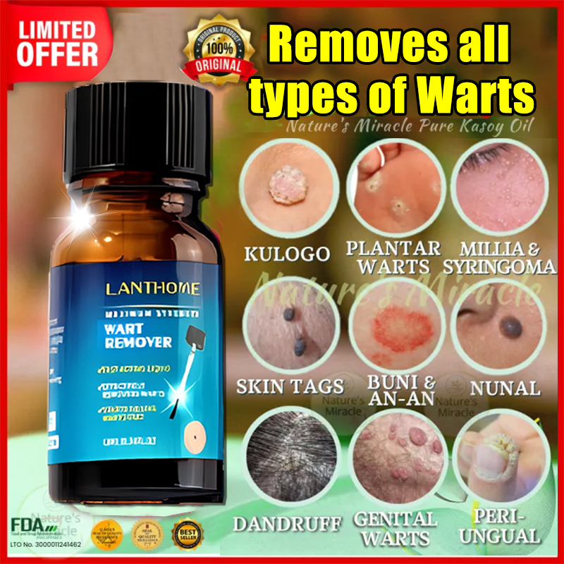 Ubat ketuat Tahi lalat remover Skin Tag, Mole, Corn & Wart Removal 8ml ...