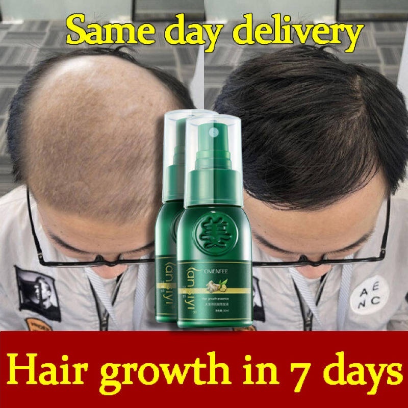 Hair Growth Serum 生发液 Hair Tonic Spray Ubat Rambut Gugur lelaki Anti ...