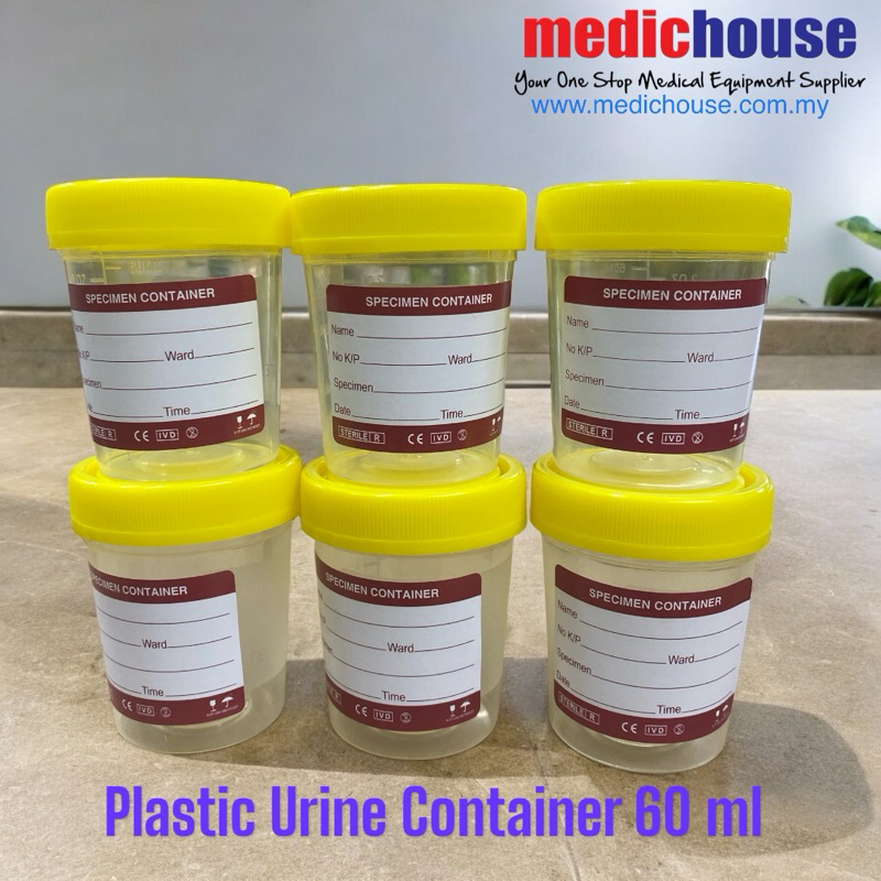 URINE SPECIMEN Container 60ml ,Yellow Screw Cap(price/pc) | Shopee Malaysia