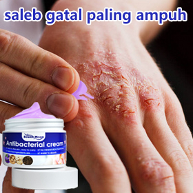 Antibacterial Cream Ubat Gatal Kemaluan Krim Gatal Eczema Itchy ...