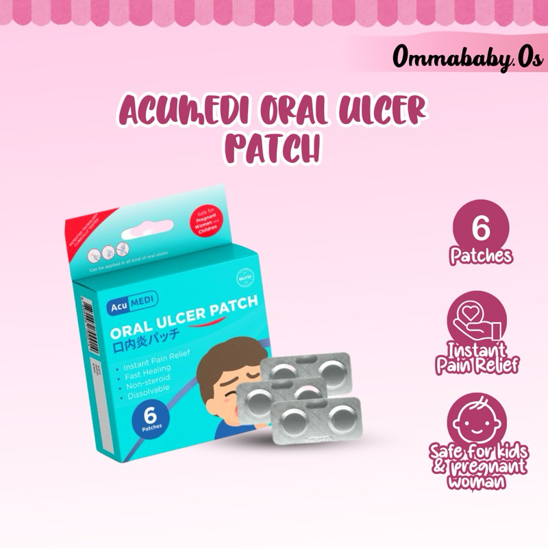 {READYSTOCK} Oral ulser patch for treatment | Shopee Malaysia