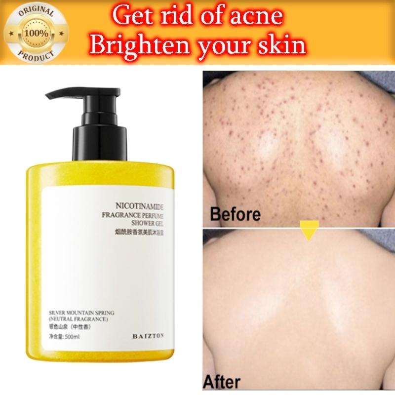 Sabun jerawat badan Acne treatment Relieve itching Remove mites Acne ...