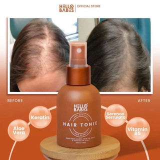 HELLOBABES. Hair Tonic (100ml) | Shampoo (250ml) | Shopee Malaysia