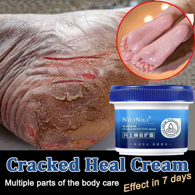 Heel Chapped Heal Cream Cracking Repair Moisturizer 40g Vaseline ...
