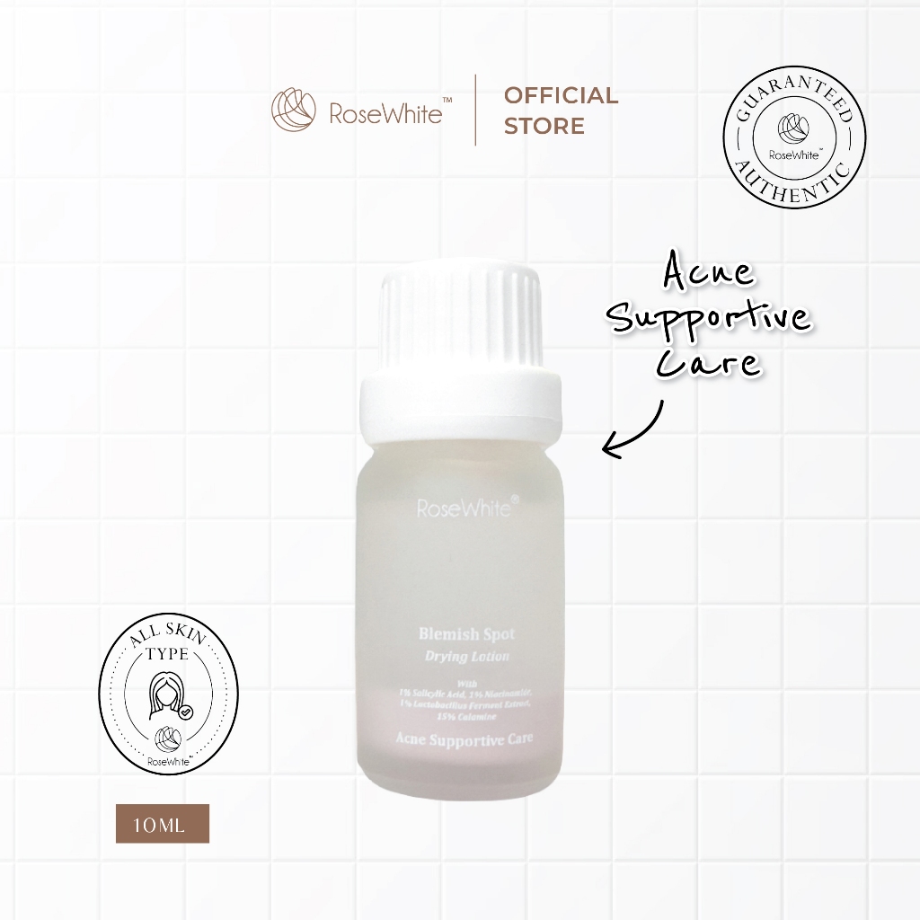 Rosewhite Blemish Spot Acne Spot Dots Drying Lotion (10ml) | Shopee ...