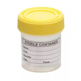 Urine Container Urine Collector Sample Yellow 60ml Sterile/Non-Sterile ...