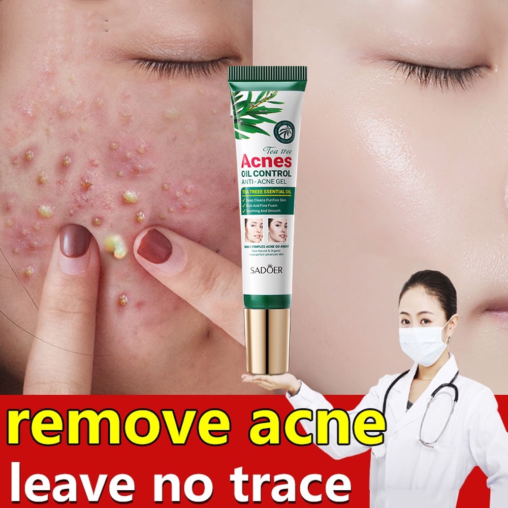 Acne cream hilangkan parut jerawat ubat jerawat dan parut krim jerawat ...