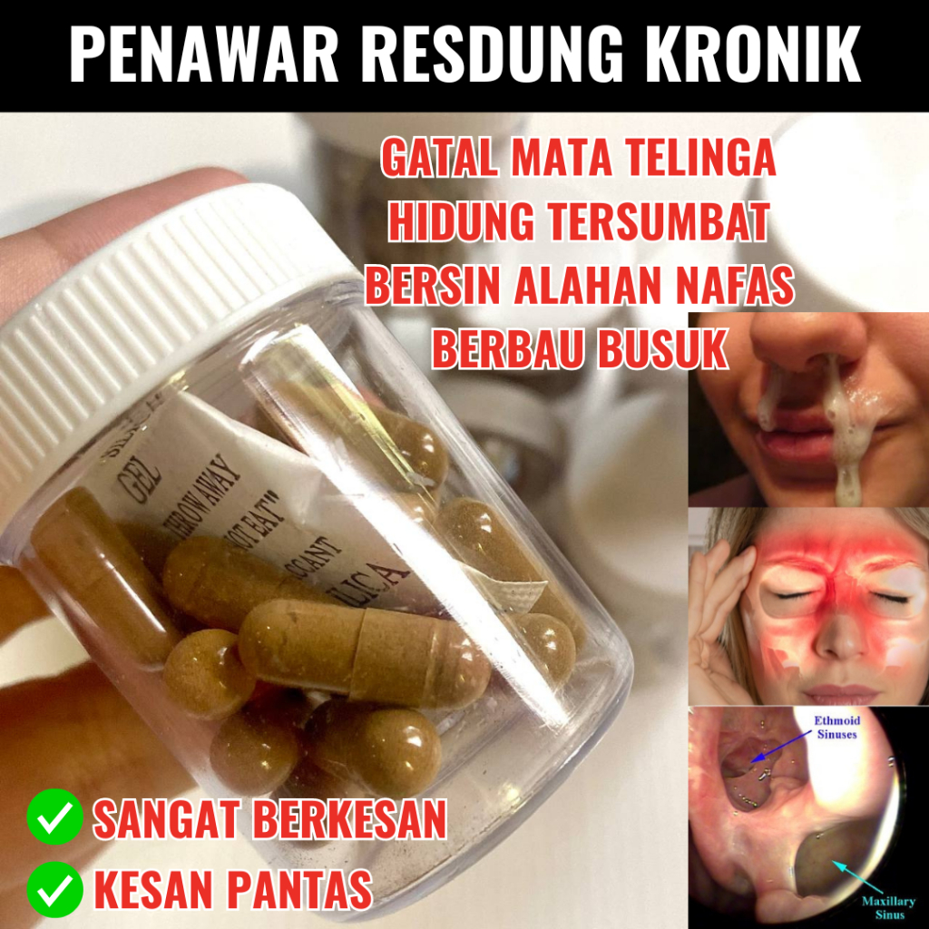 UBAT RESDUNG TURUN TEMURUN DIJAMIN BERKESAN, PENAWAR RESDUNG MUJARAB ...