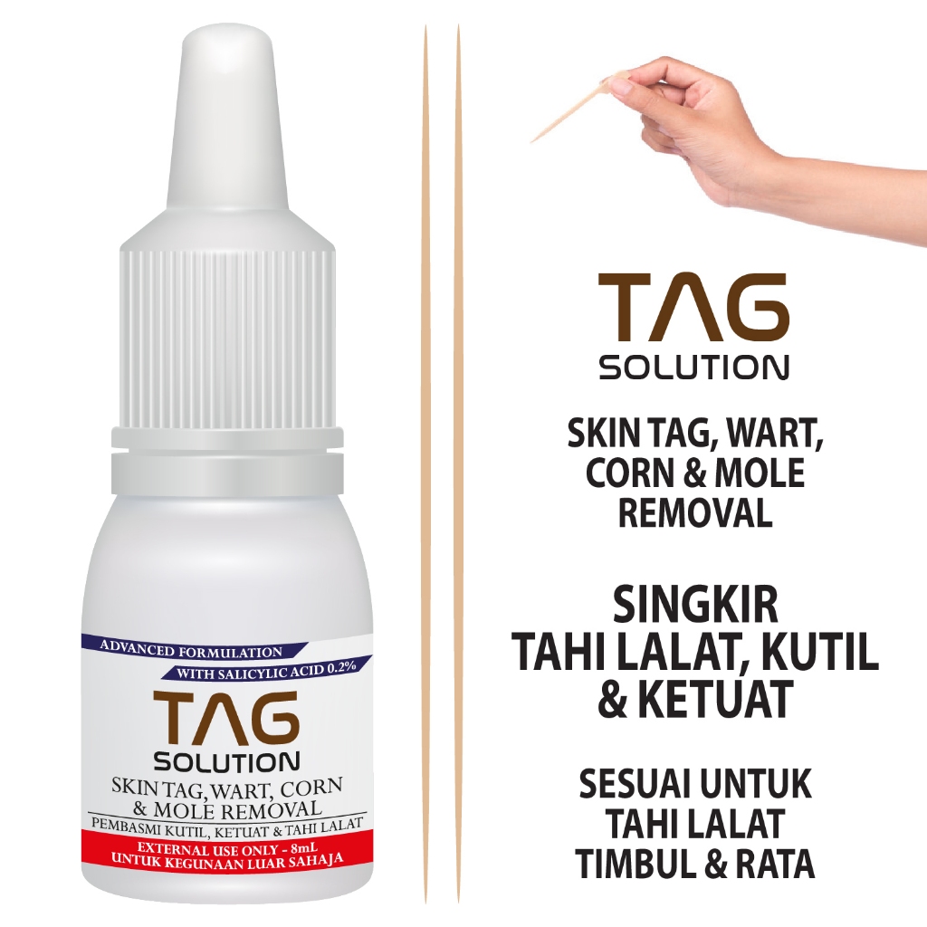 Alat Buang Tahi Lalat, Kutil, Ketuat, Ketuat Kaki - Skin Tag, Mole ...