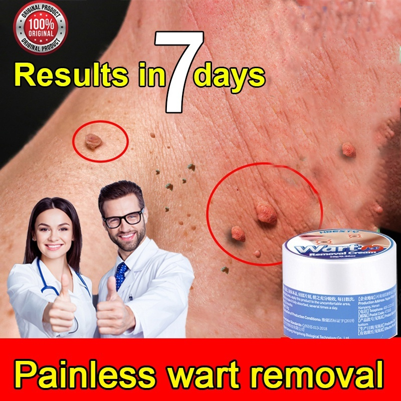 Wart Removal Cream Skin Tag Remover Mole Remover Ubat Kutil Buang Tahi ...
