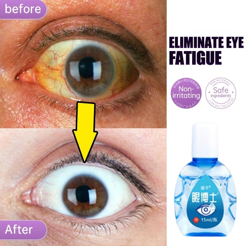 Eye Drops for cataract dry eye ubat katarak mata ubat mata merah ubat ...