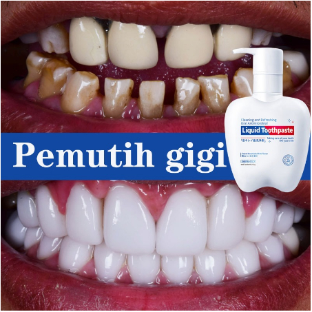 pemutih gigi Probiotic Toothpaste 120g teeth whitening toothpaste ubat gigi pemutih ubat gigi ...