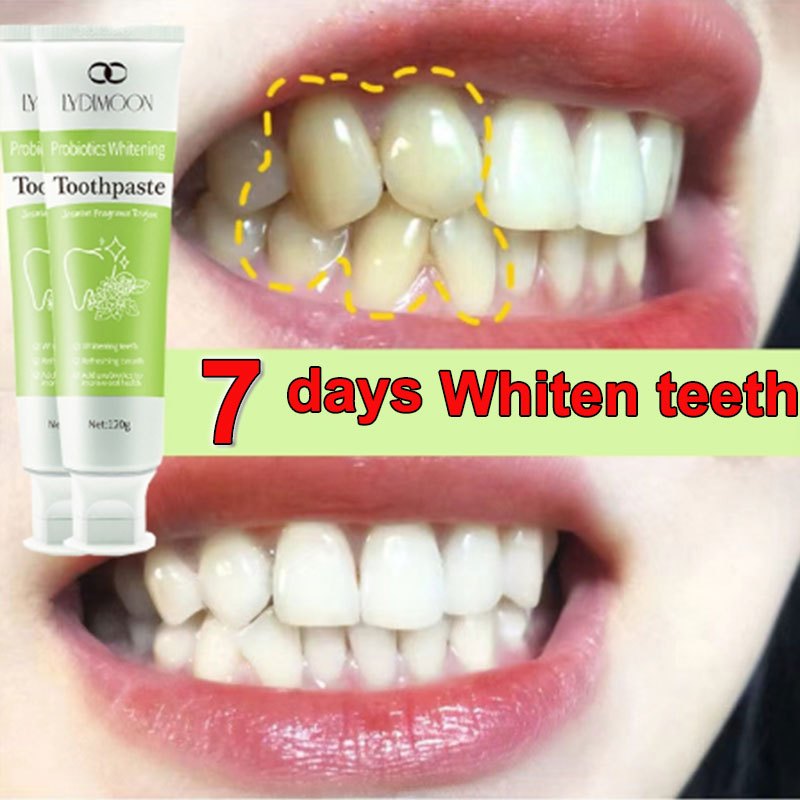whitening toothpaste 美白牙膏 ubat gigi pemutih 120g whitening teeth No bad ...