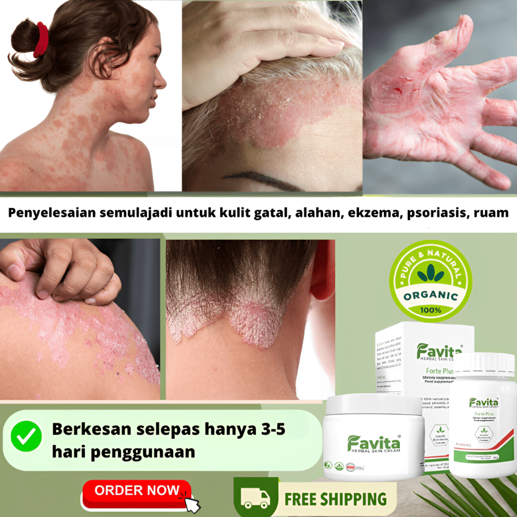 Obat Gatal Untuk Kulit Favita Solusi Efektif Untuk Dermatitis Psoriasis ...