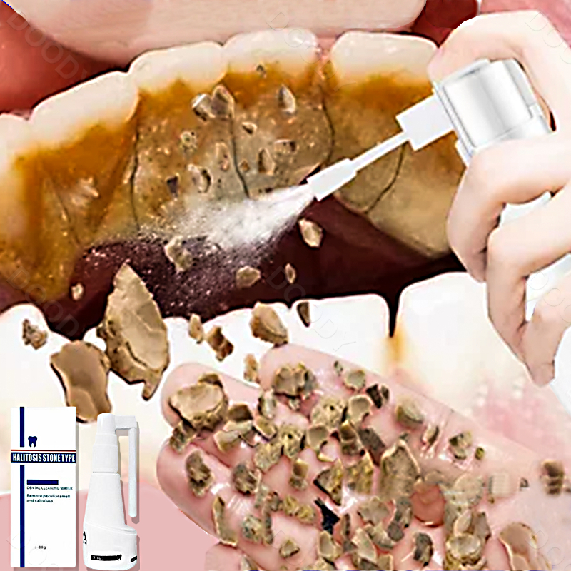 tartar remover spray karang gigi remover ubat gigi pemutih Remove bad ...