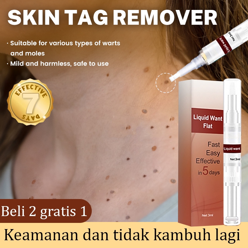 Ubat Ketuat Skin Tag Mole Remover wart removal liquid pen ubat buang ...
