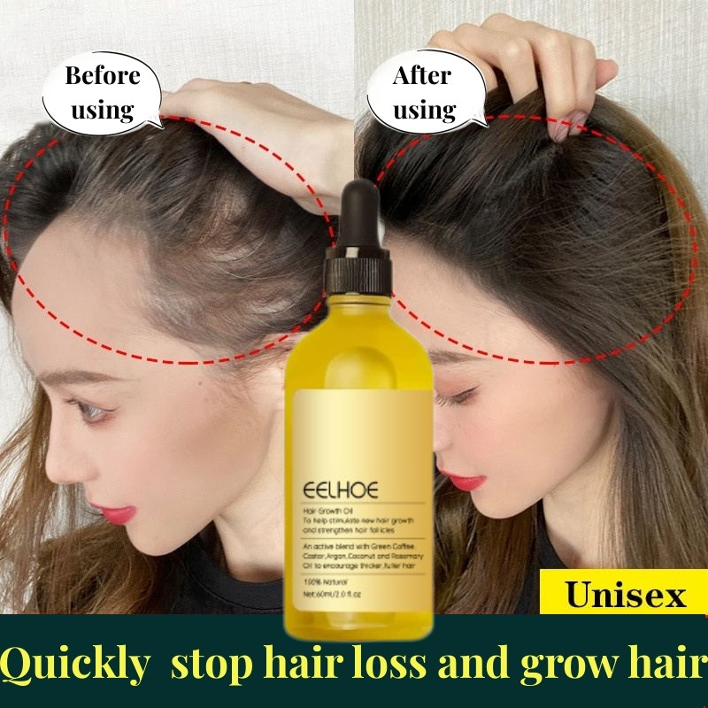 Rosemary Oil For Hair Growth Essential Oil Hair Growth Oil Ubat Rambut ...
