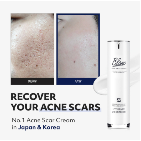 Blanc Nature Acne Scar Cream Centella & Snail Moisturizer Pimple Acne ...