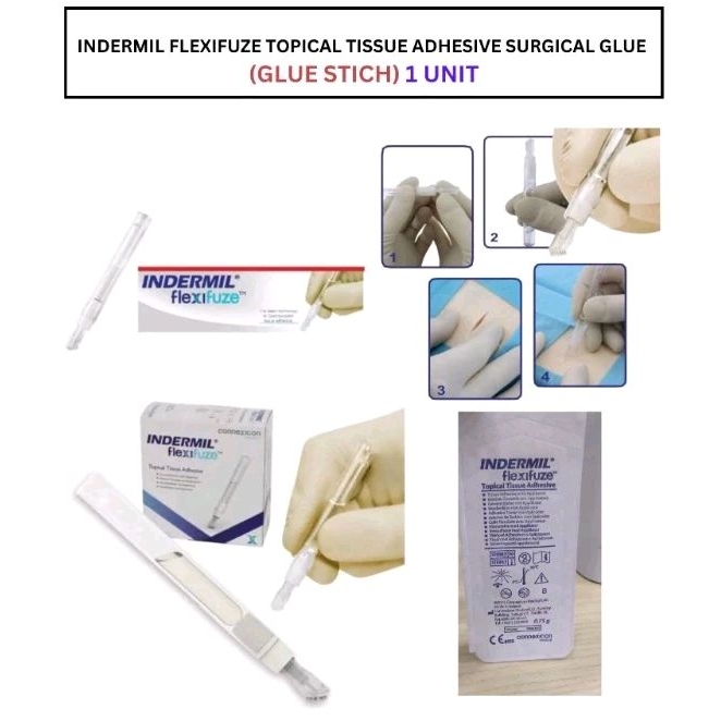 MDA ️ (Long Expiry) INDERMIL FLEXIFUZE TOPICAL TISSUE ADHESIVE SURGICAL ...