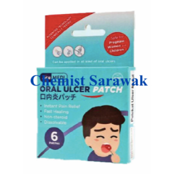 AcuMEDI Oral Ulcer Patch 6's Patches | Shopee Malaysia