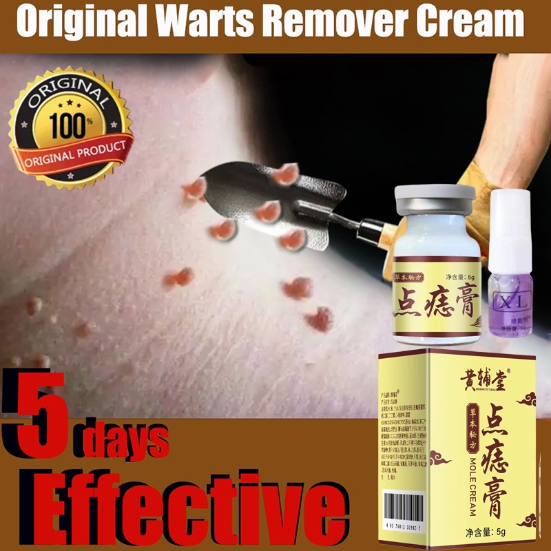 Mole remover cream warts removal skin tag remover skin tag melanin ubat ...