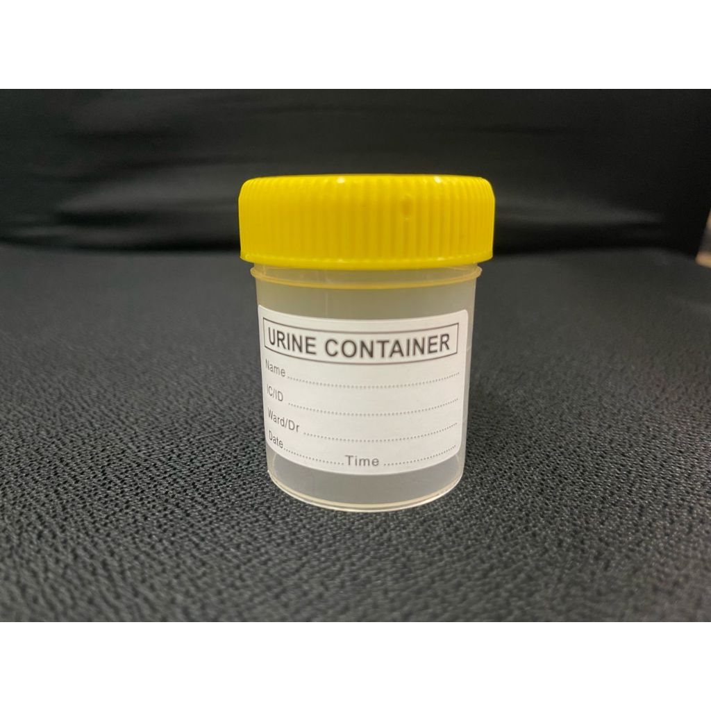 URINE CONTAINER non-sterile 60ml (pack of 6pcs) | Shopee Malaysia