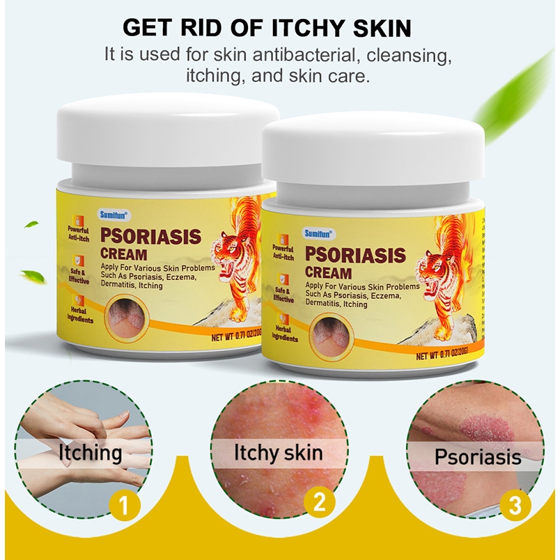 Psoriasis Cream Antifungal cream Eczema cream Cream gatal kulit 20g ...