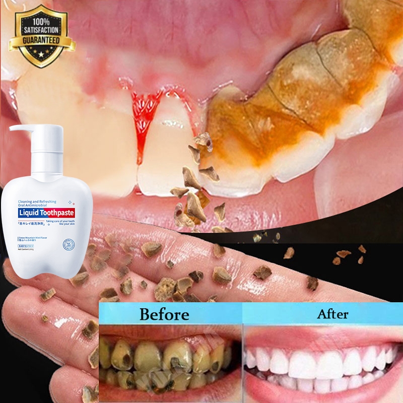 teeth whitening toothpaste liquid probiotic pemutih gigi kuning Remove ...