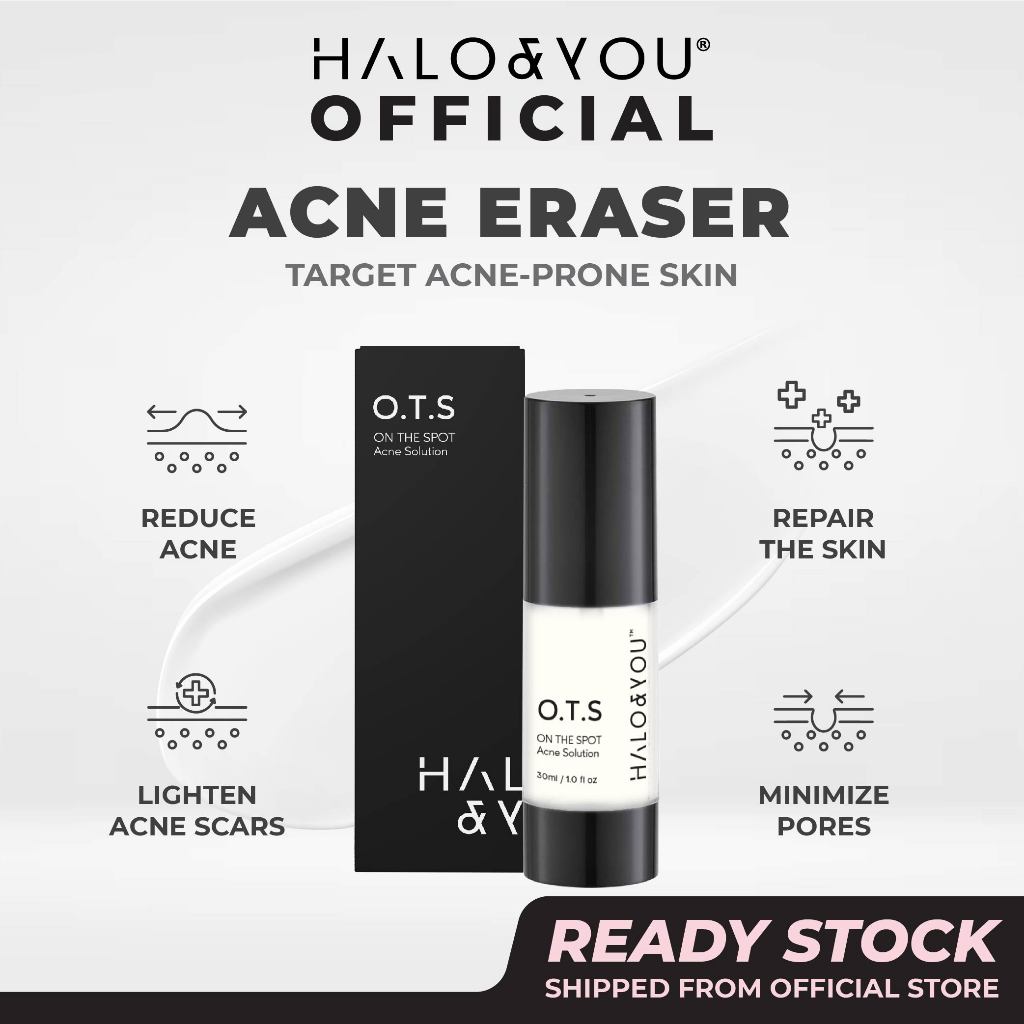 OFFICIAL Halo and You _ O.T.S ON THE SPOT ACNE SOLUTION | Shopee Malaysia