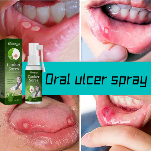 Ubat Ulser Mulut Oral Ulcer Spray Ubat Ulser Mulut Kanak Kanak Ubat ...