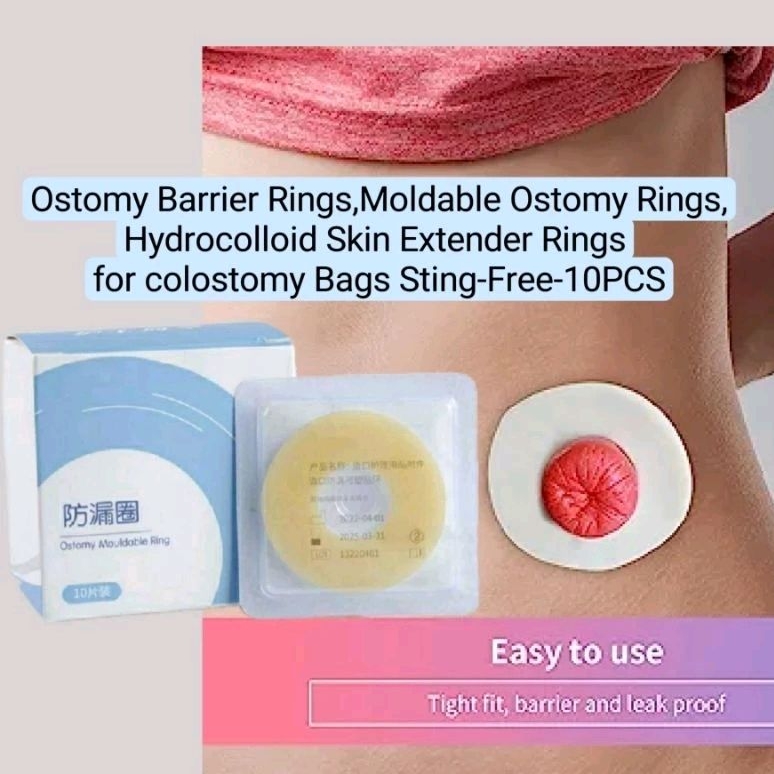 10pcs [4mm] Ostomy Barrier Stoma Rings Moldable Ostomy Rings ...