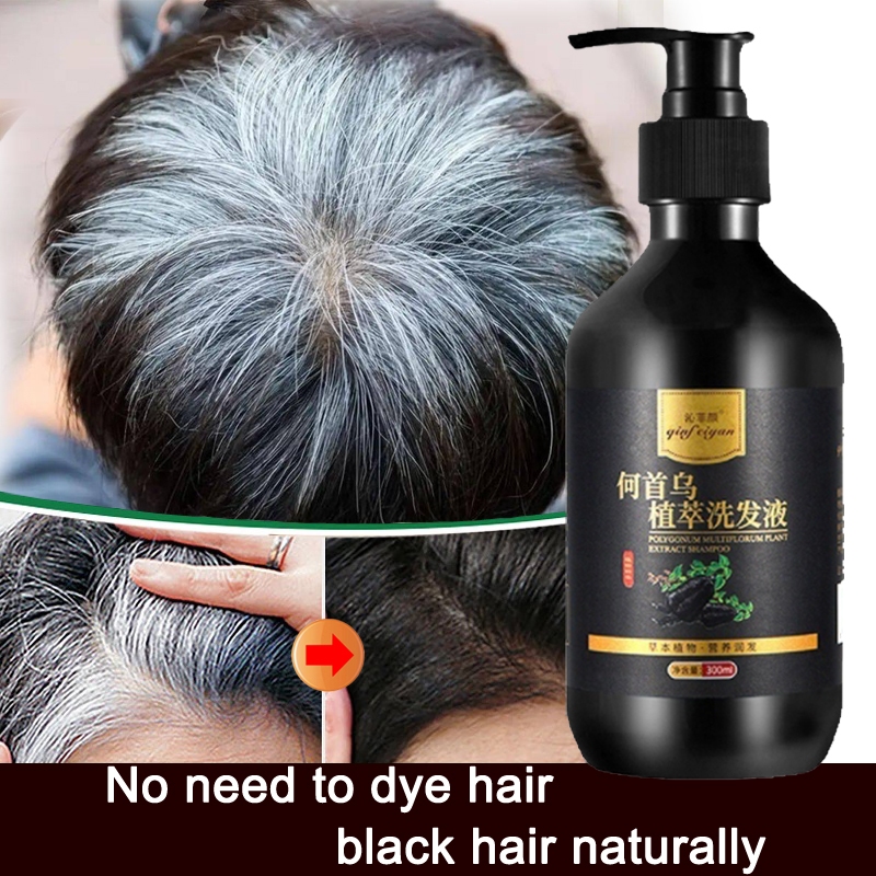 black hair shampoo hair growth shampoo hair loss shampoo 300ml Reduce ...