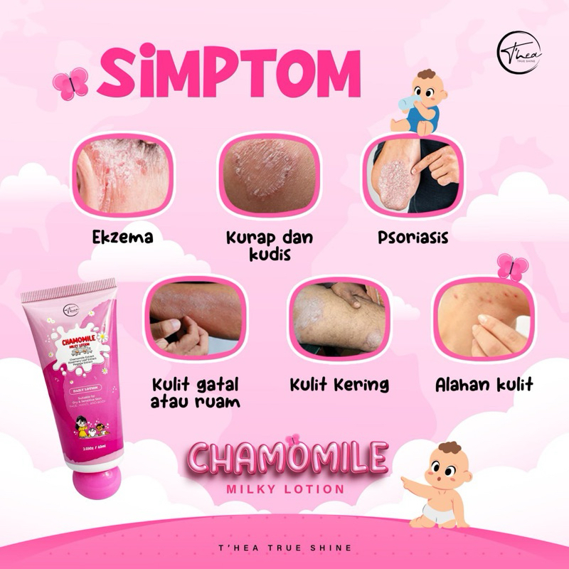 FREEGIFT Thea Chamomile Treatment Lotion eczema gatal elergik psiorasis ...