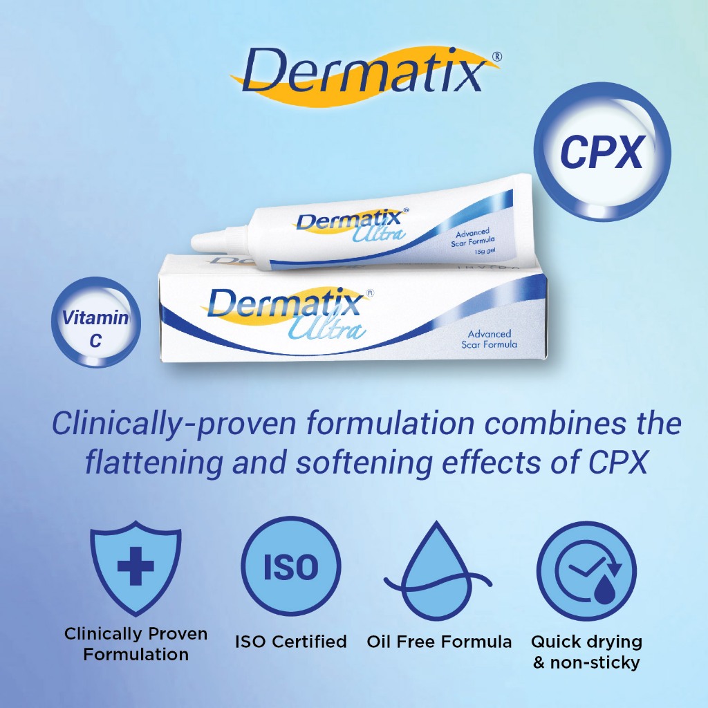 Dermatix Ultra Advanced Scar Formula 15G | Shopee Malaysia