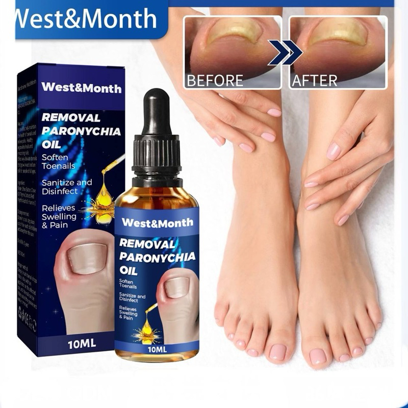 WestMonth REMOVAL PARONYCHIA OIL Minyak pembaikan kuku halang kuku ...